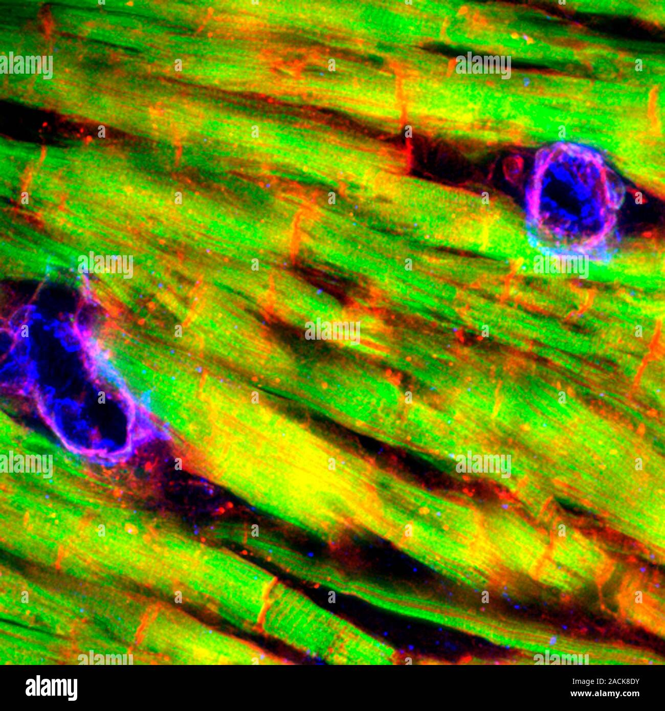 Heart tissue. Fluorescence deconvolution micrograph of a section ...