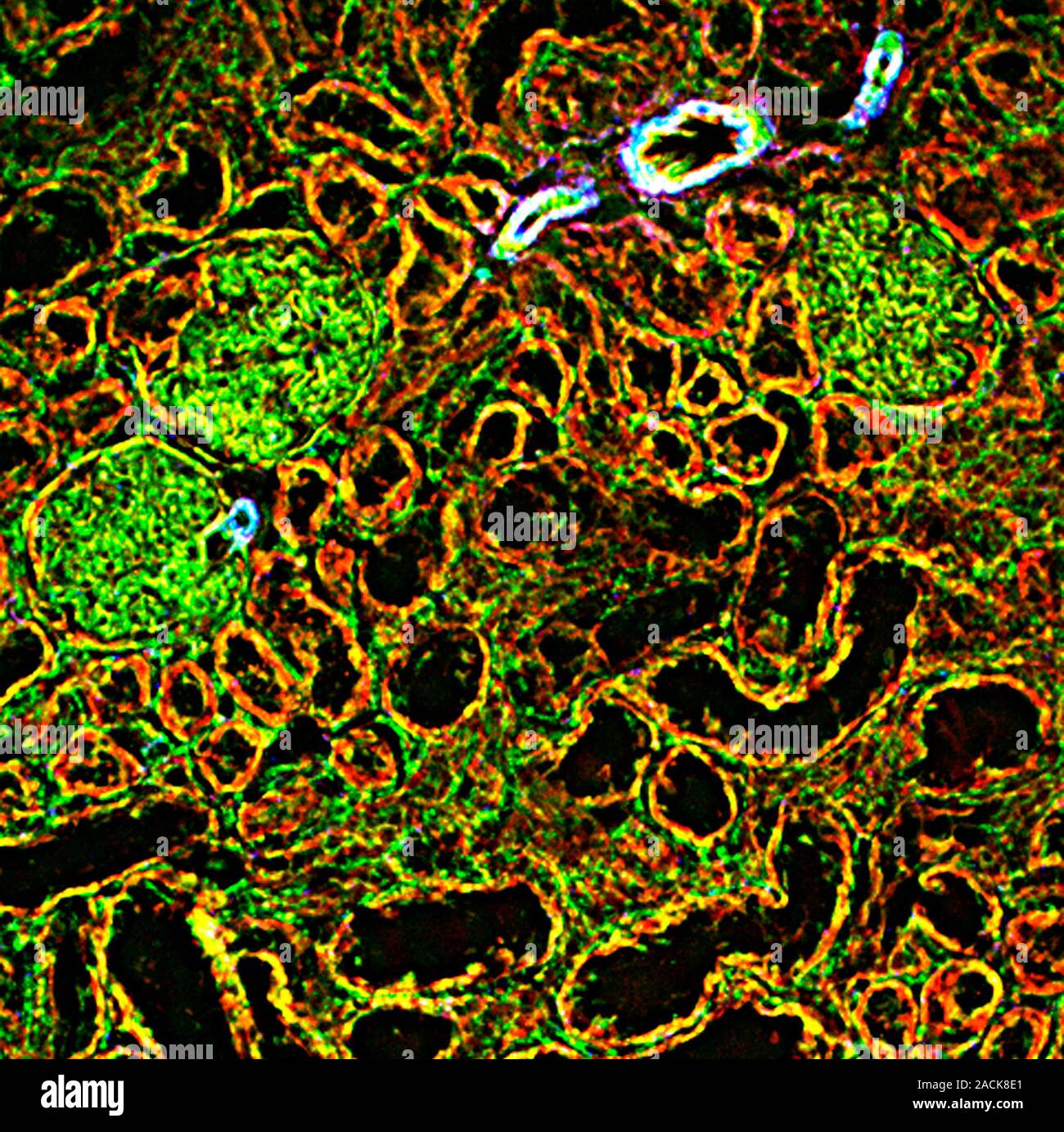 Kidney tissue. Fluorescence deconvolution micrograph of a section ...