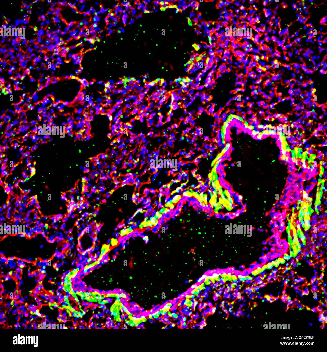 Lung Tissue Fluorescence Deconvolution Micrograph Of A Section Through