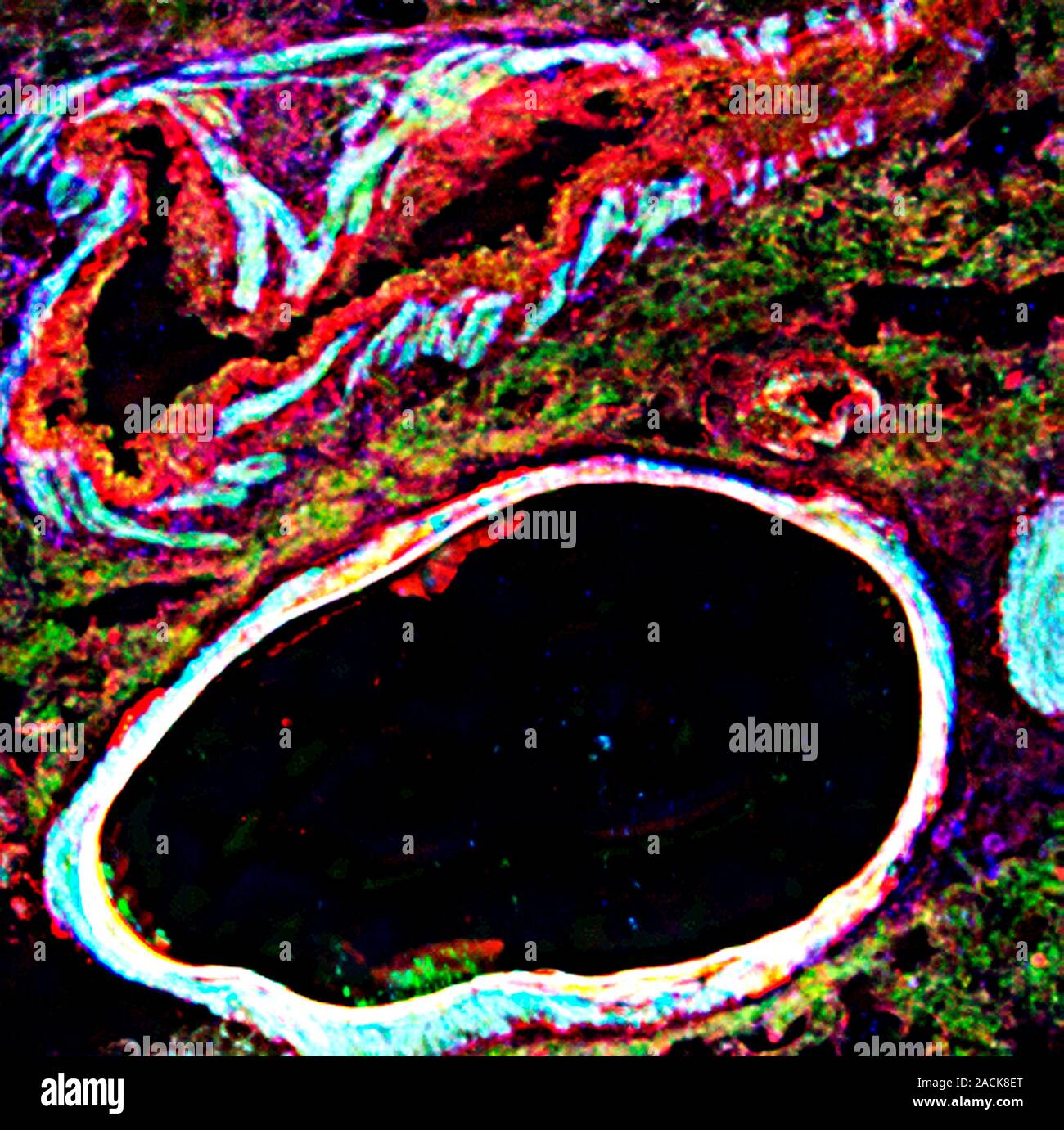 Lung Tissue Fluorescence Deconvolution Micrograph Of A Section Through