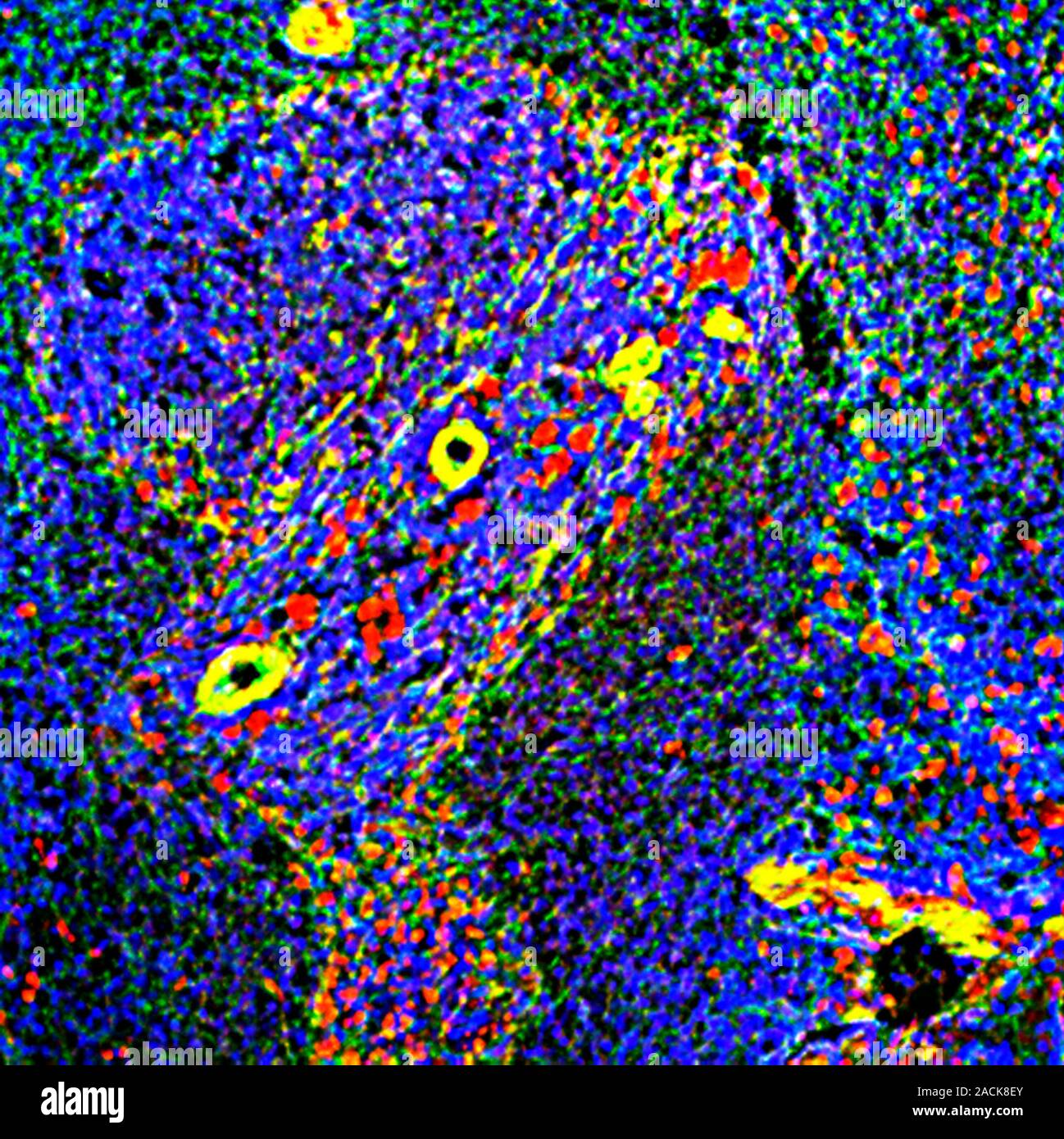 Spleen Tissue Fluorescence Deconvolution Micrograph Of A Section