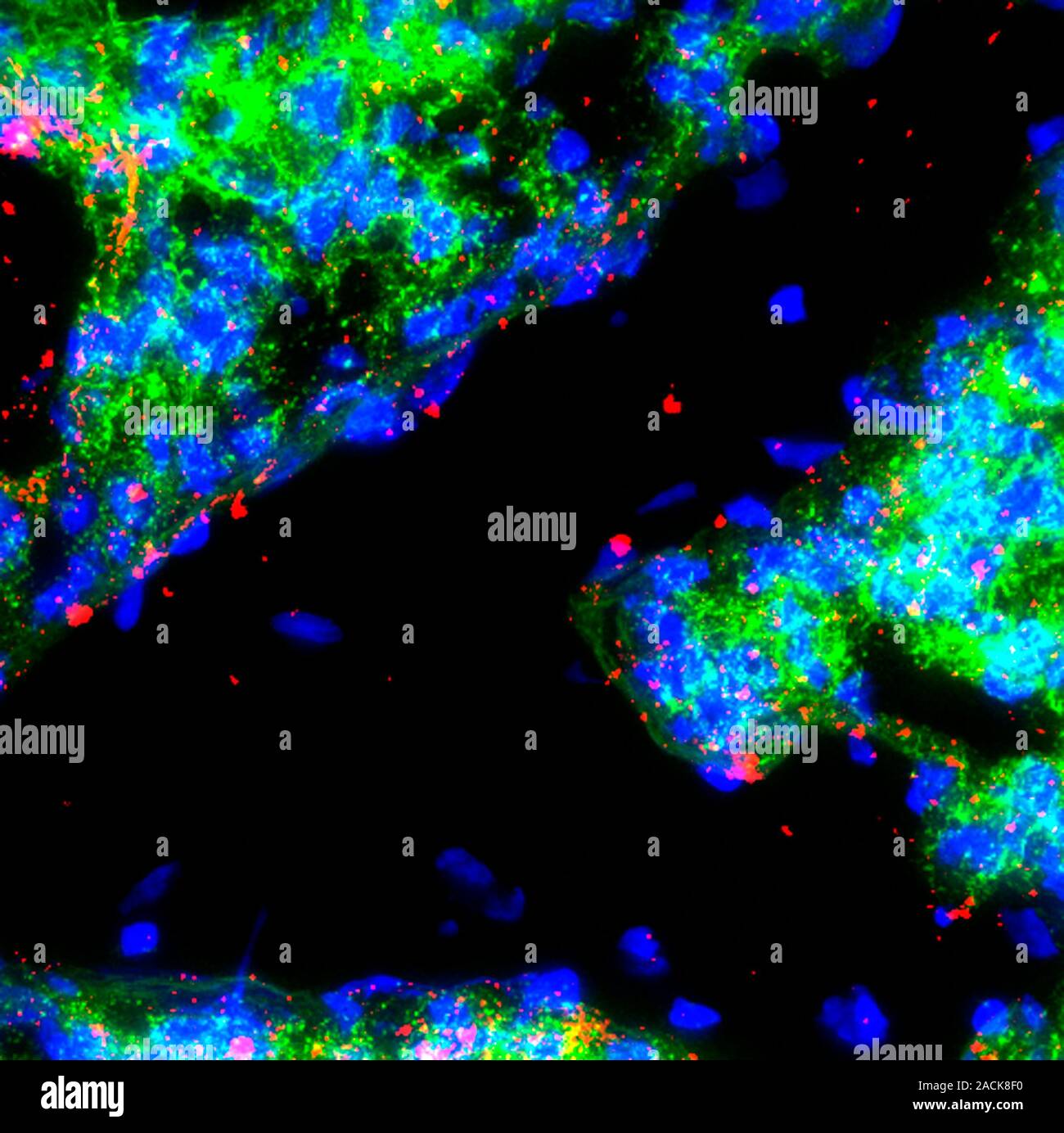 Lung tissue. Fluorescence deconvolution micrograph of a section through ...