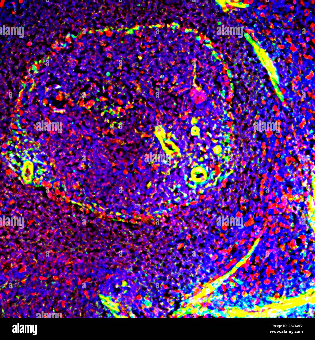 Spleen tissue. Fluorescence deconvolution micrograph of a section ...