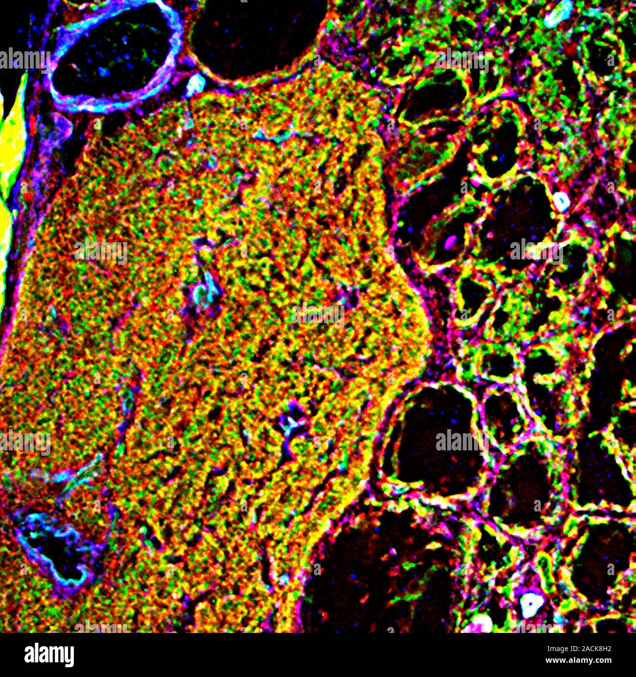 Throat tissue. Fluorescence deconvolution micrograph of a section ...