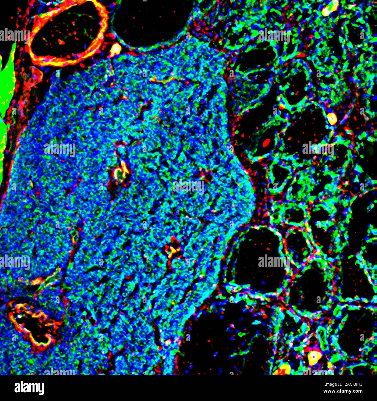 Throat Tissue Fluorescence Deconvolution Micrograph Of A Section