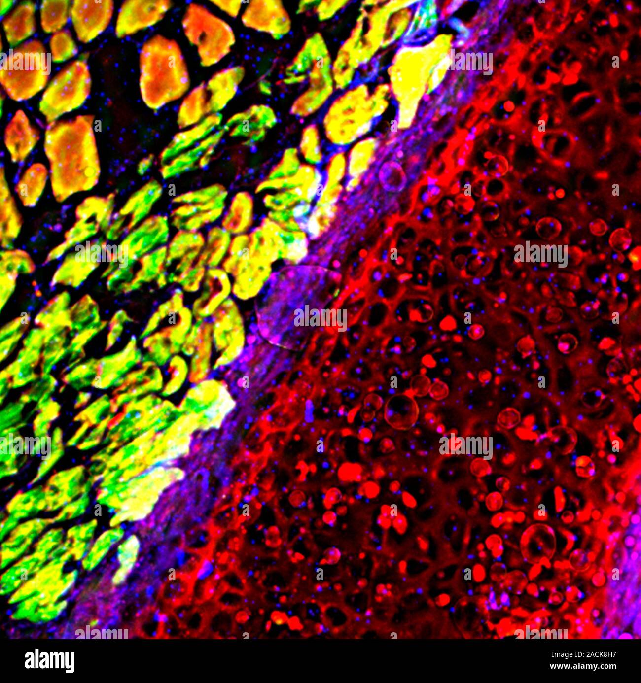 Throat Tissue Fluorescence Deconvolution Micrograph Of A Section
