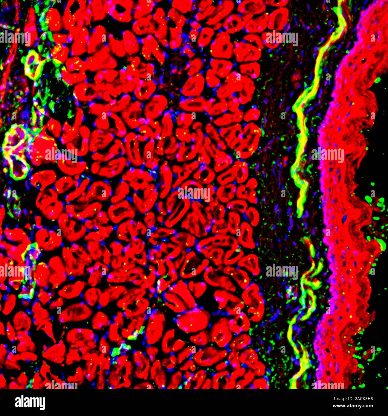 Throat Tissue Fluorescence Deconvolution Micrograph Of A Section