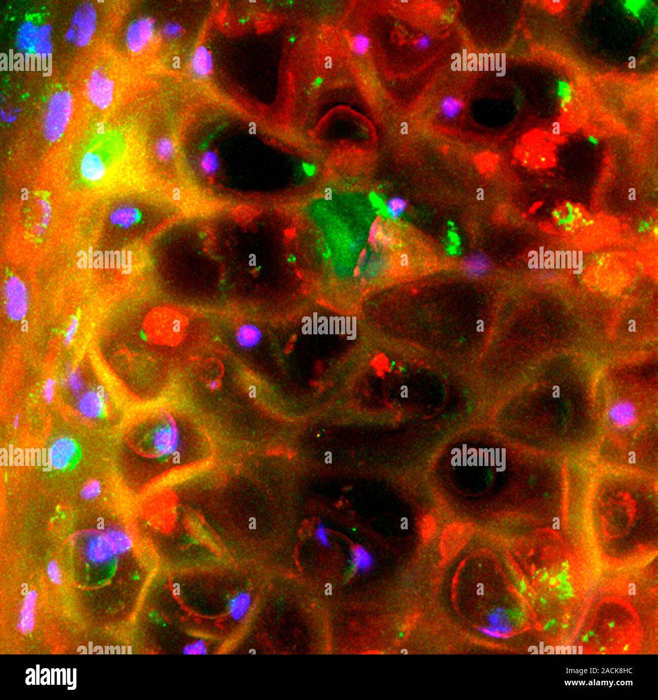 Throat Tissue Fluorescence Deconvolution Micrograph Of A Section