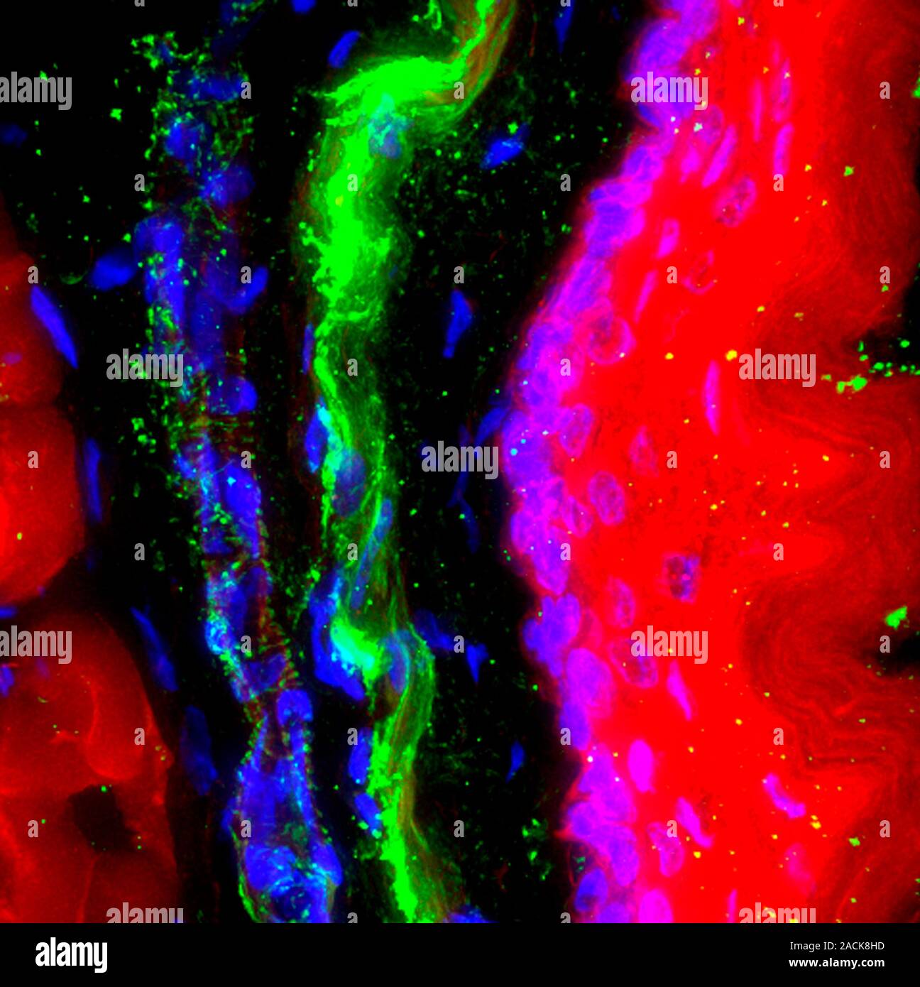 Throat Tissue Fluorescence Deconvolution Micrograph Of A Section