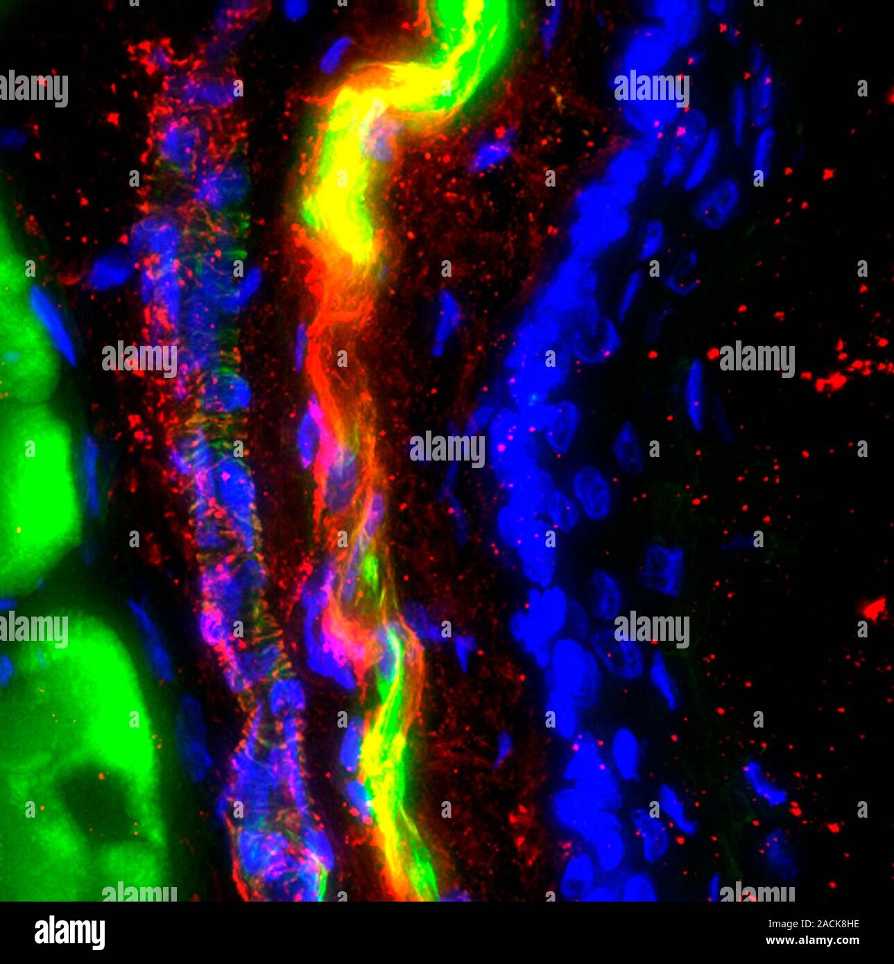 Throat Tissue Fluorescence Deconvolution Micrograph Of A Section Through Throat Tissue This