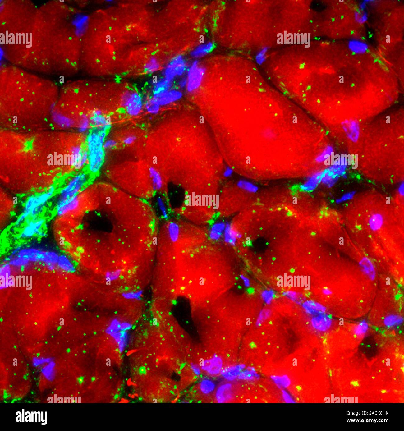 Throat Tissue Fluorescence Deconvolution Micrograph Of A Section