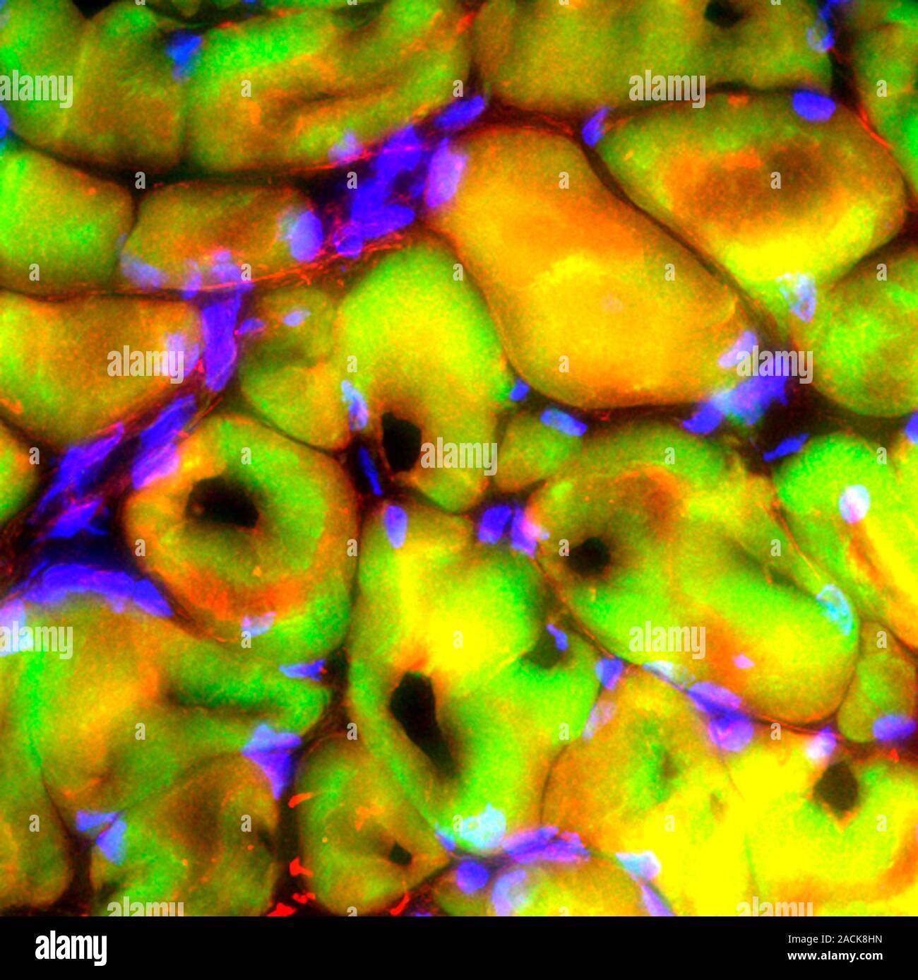 Throat Tissue Fluorescence Deconvolution Micrograph Of A Section