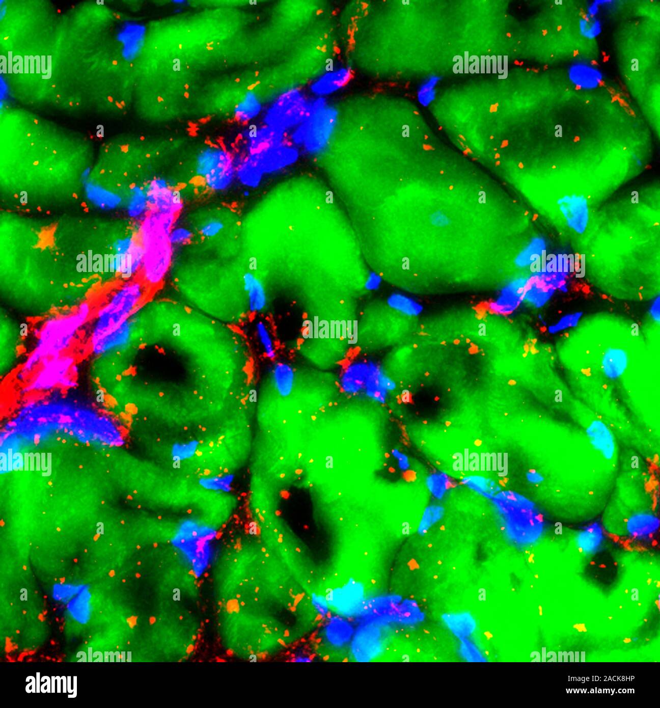 Throat Tissue Fluorescence Deconvolution Micrograph Of A Section