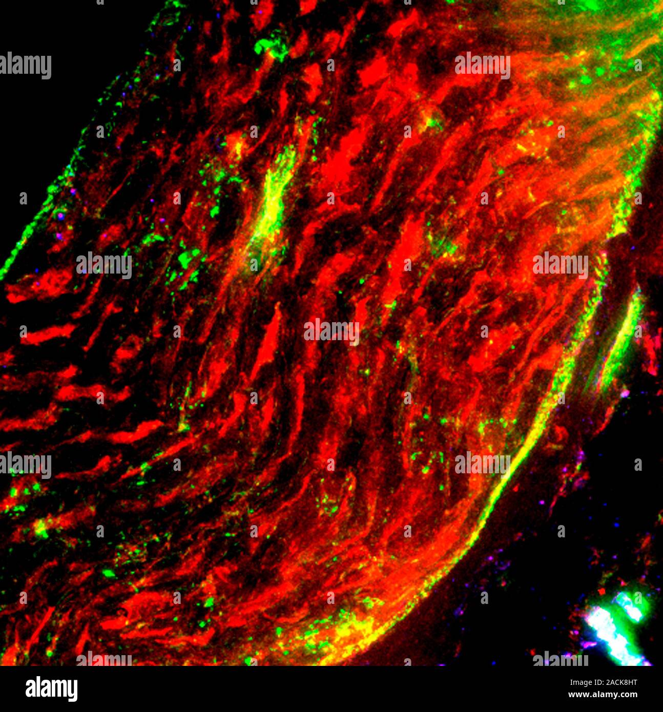 Throat Tissue Fluorescence Deconvolution Micrograph Of A Section