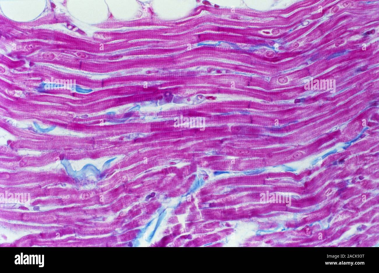 Cardiac muscle, light micrograph. The heart largely consists of fibres ...