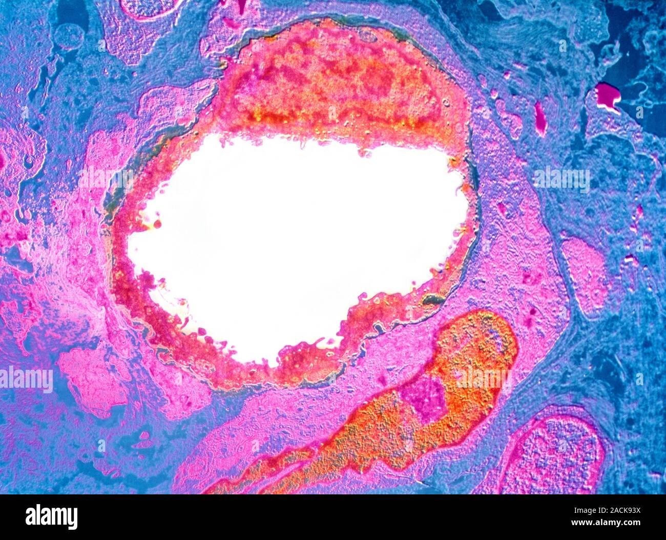Capillary cross-section, coloured transmission electron micrograph (TEM). The lumen (white) is ...