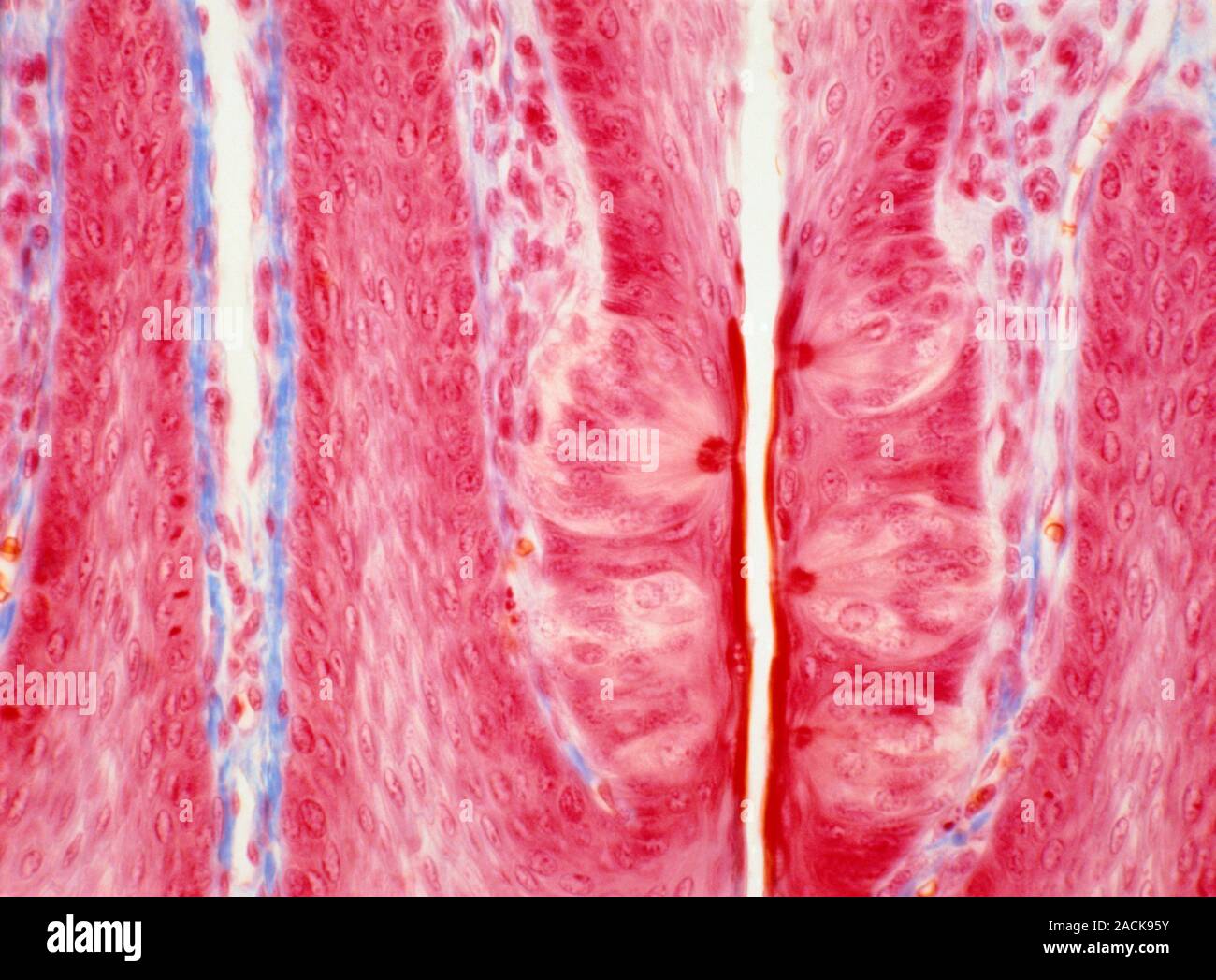 Tongue taste buds, light micrograph. The tongue is covered in numerous ...