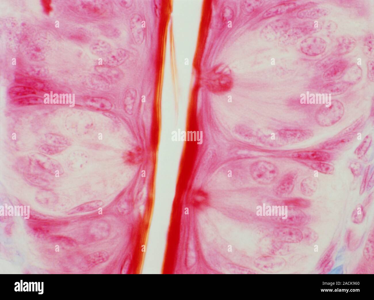 Tongue taste buds, light micrograph. The tongue is covered in numerous ...