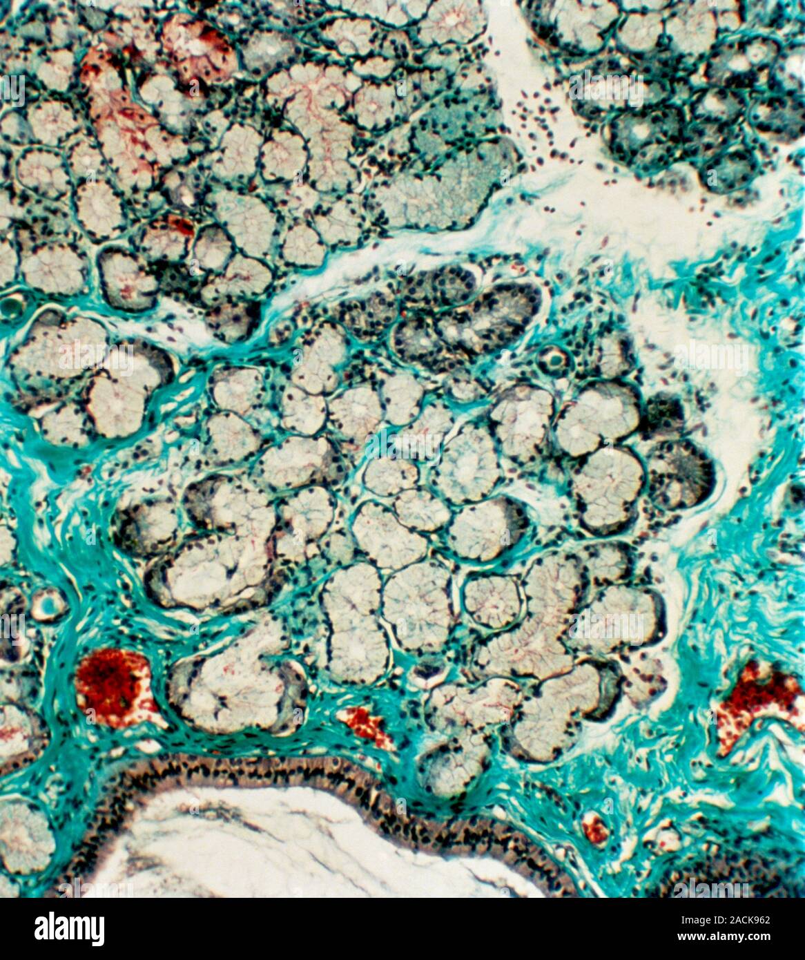 Salivary gland tissue, light micrograph. In humans there are three sets ...