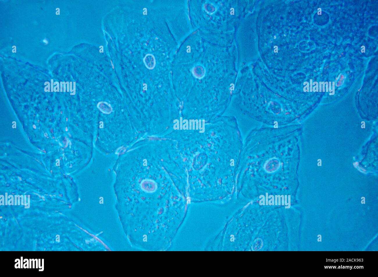 Mouth epithelial cells, interference contrast light micrograph. These ...