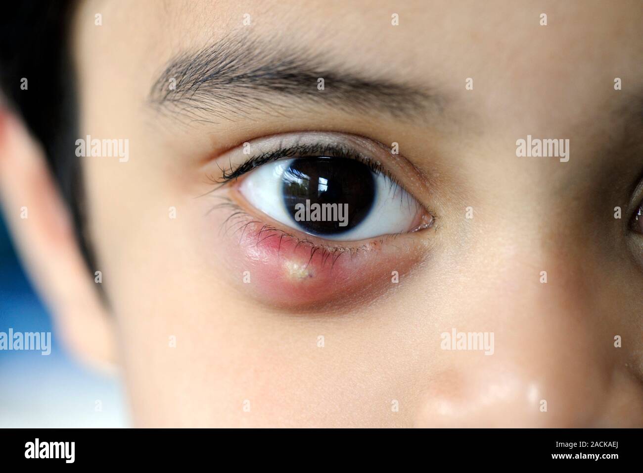 Not for use in Television Not for use in Television Close-up of a ...