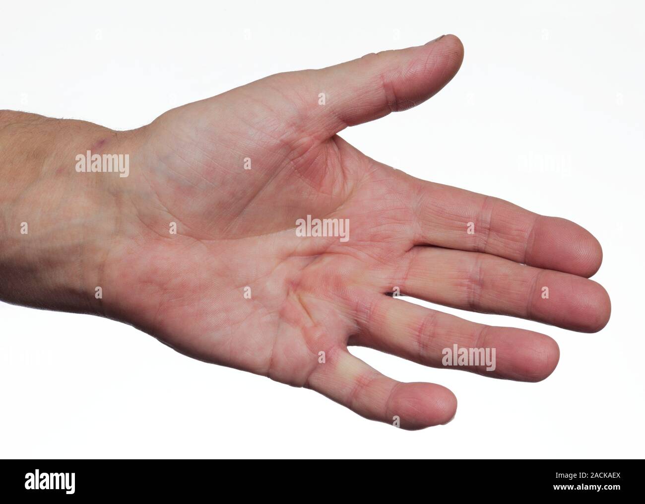 Not for use in Television Not for use in Television Early flexion ...