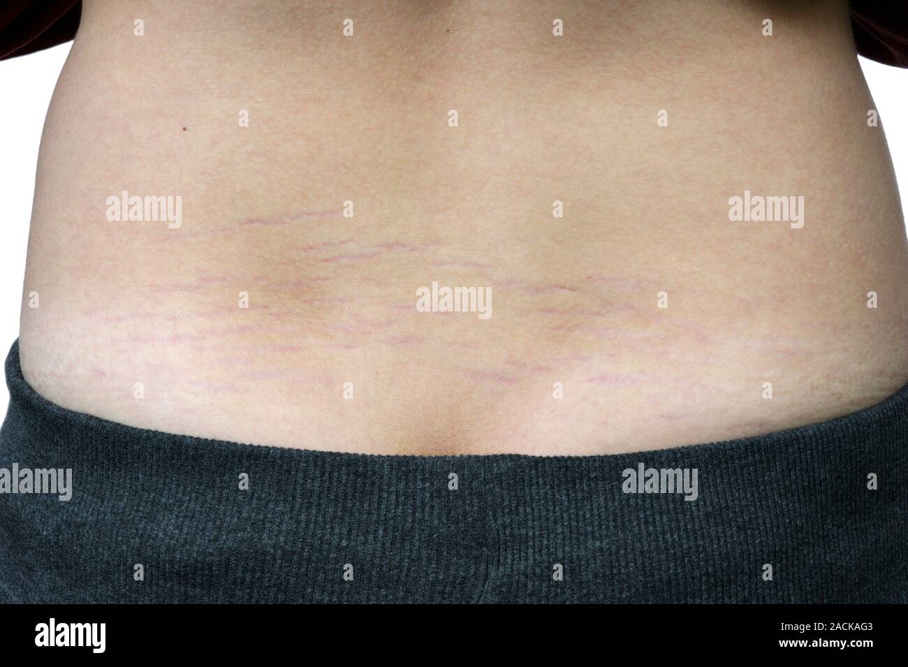 Not for use in Television Not for use in Television Striae growth marks ...