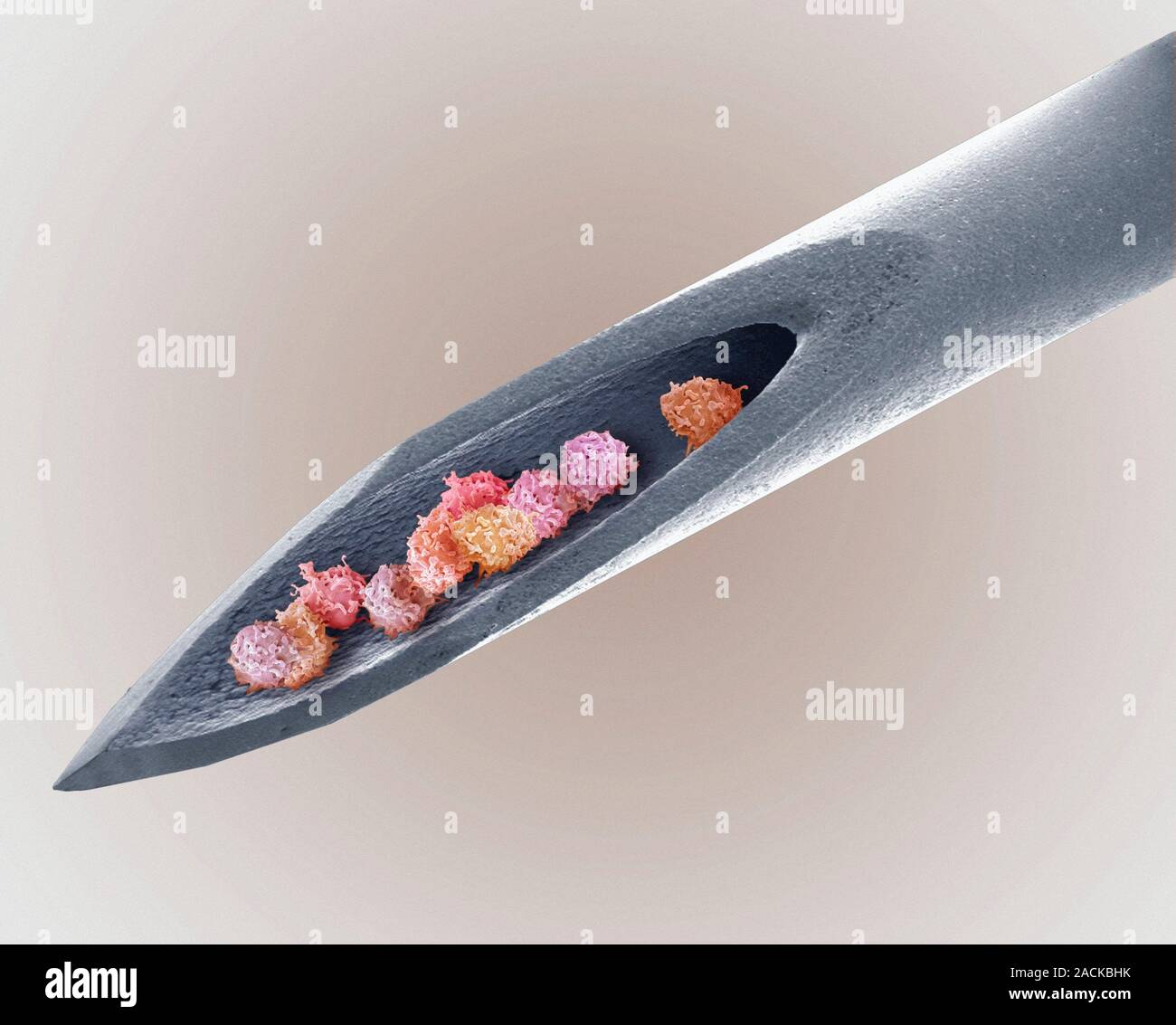 Bone marrow transplant, conceptual image. Composite coloured scanning ...