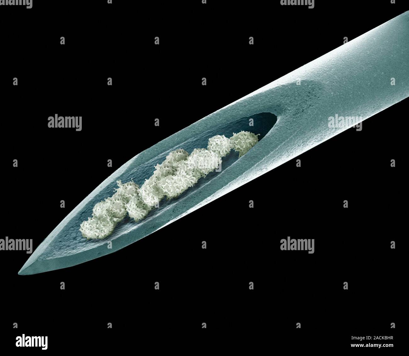Bone marrow transplant, conceptual image. Composite coloured scanning ...