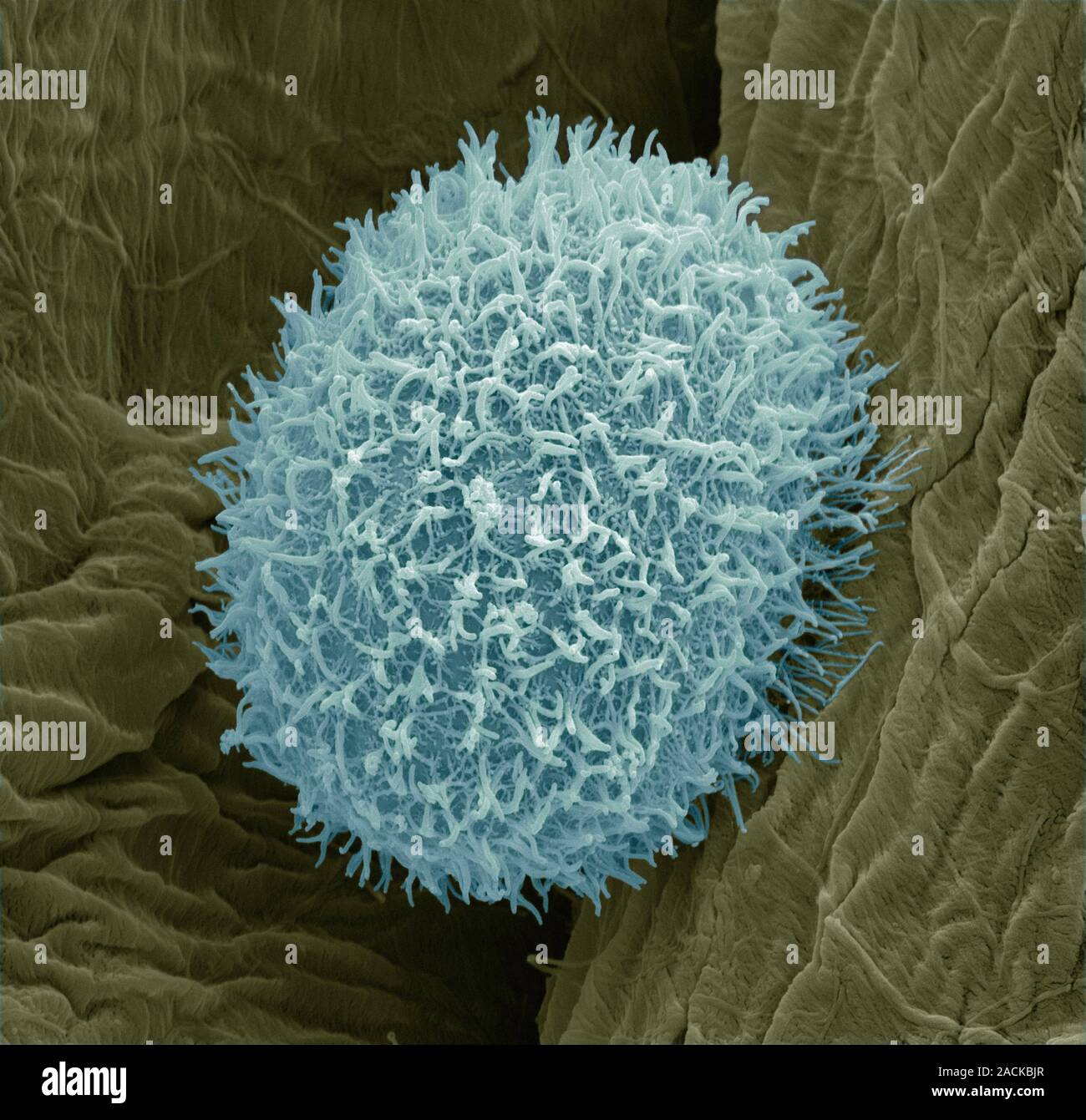 Ciliate protozoan. Coloured scanning electron micrograph (SEM) of a ...