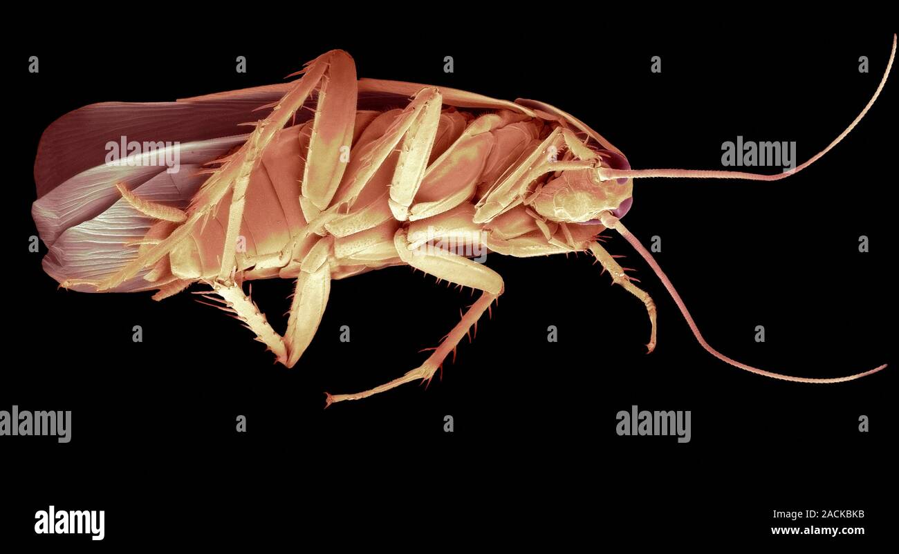 Cockroach. Coloured scanning electron micrograph (SEM) showing the ...