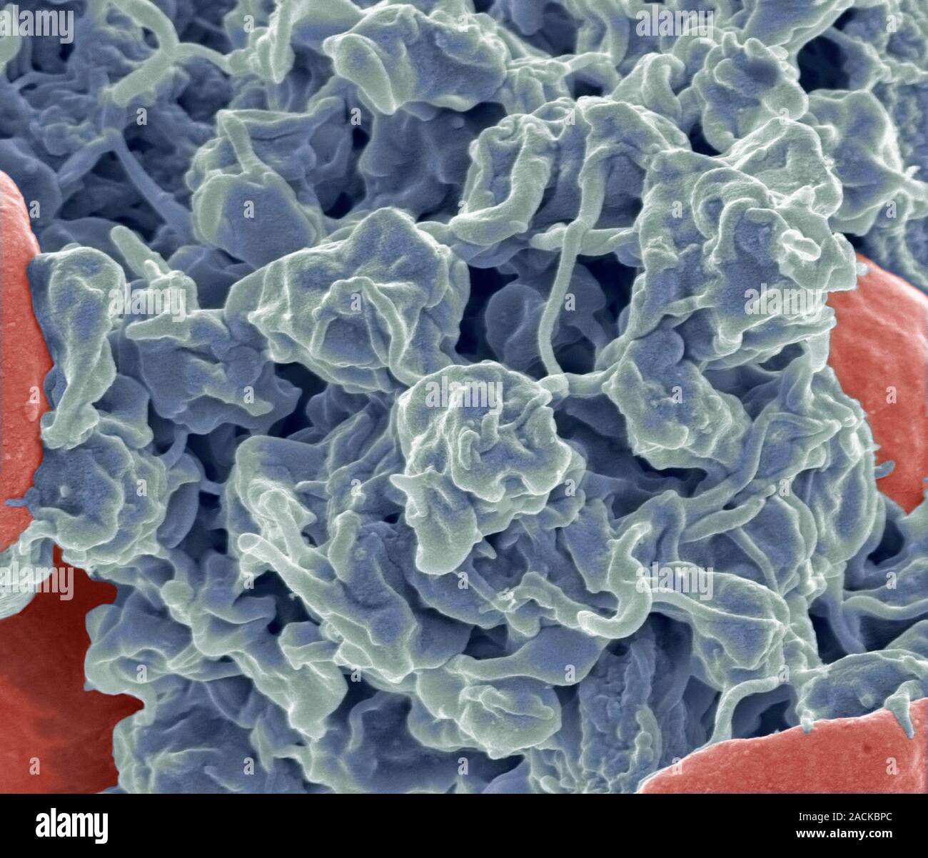 Platelets. Coloured scanning electron micrograph (SEM) of a clump of activated platelets from a ...