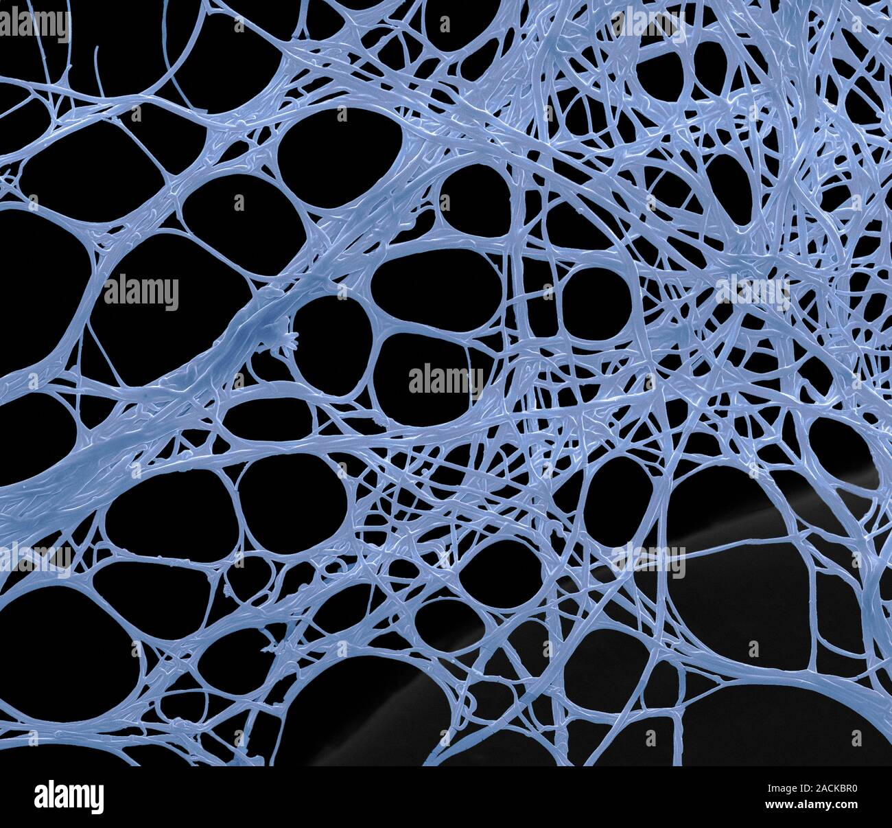 Spider silk, coloured scanning electron micrograph (SEM). Spider's silk ...