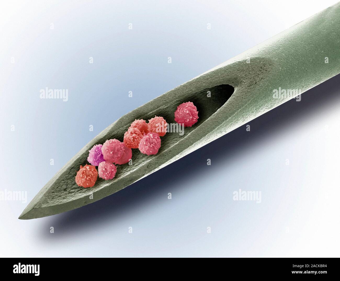 Stem cell therapy, conceptual image. Composite coloured scanning ...