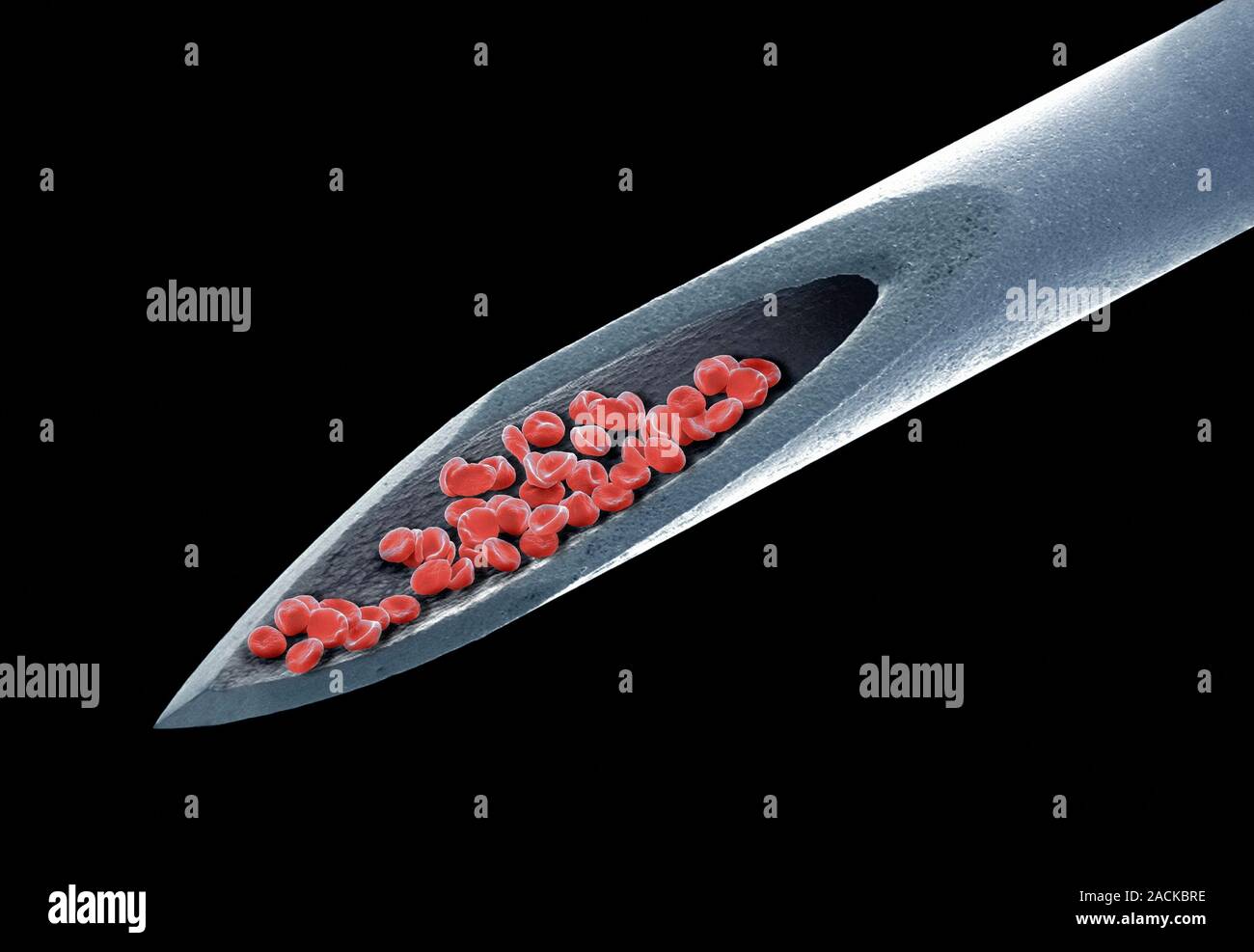 Blood on a needle. Composite coloured scanning electron micrograph (SEM ...