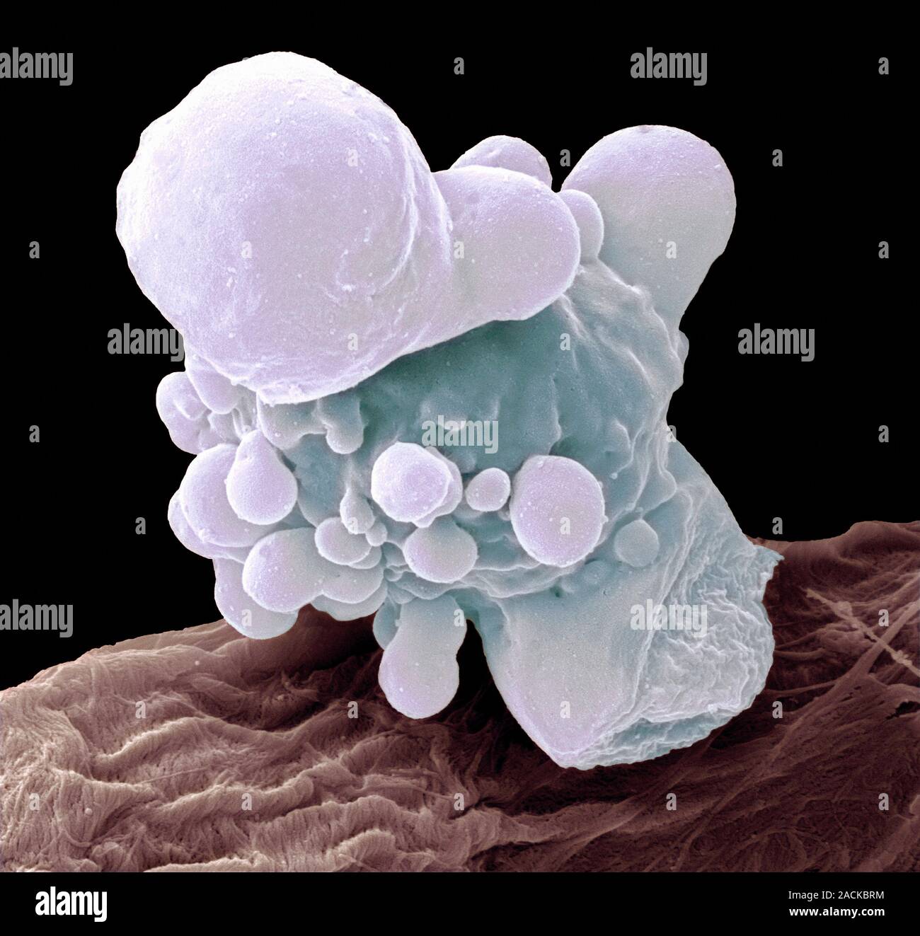 Neutrophil. Coloured scanning electron micrograph of an activated ...