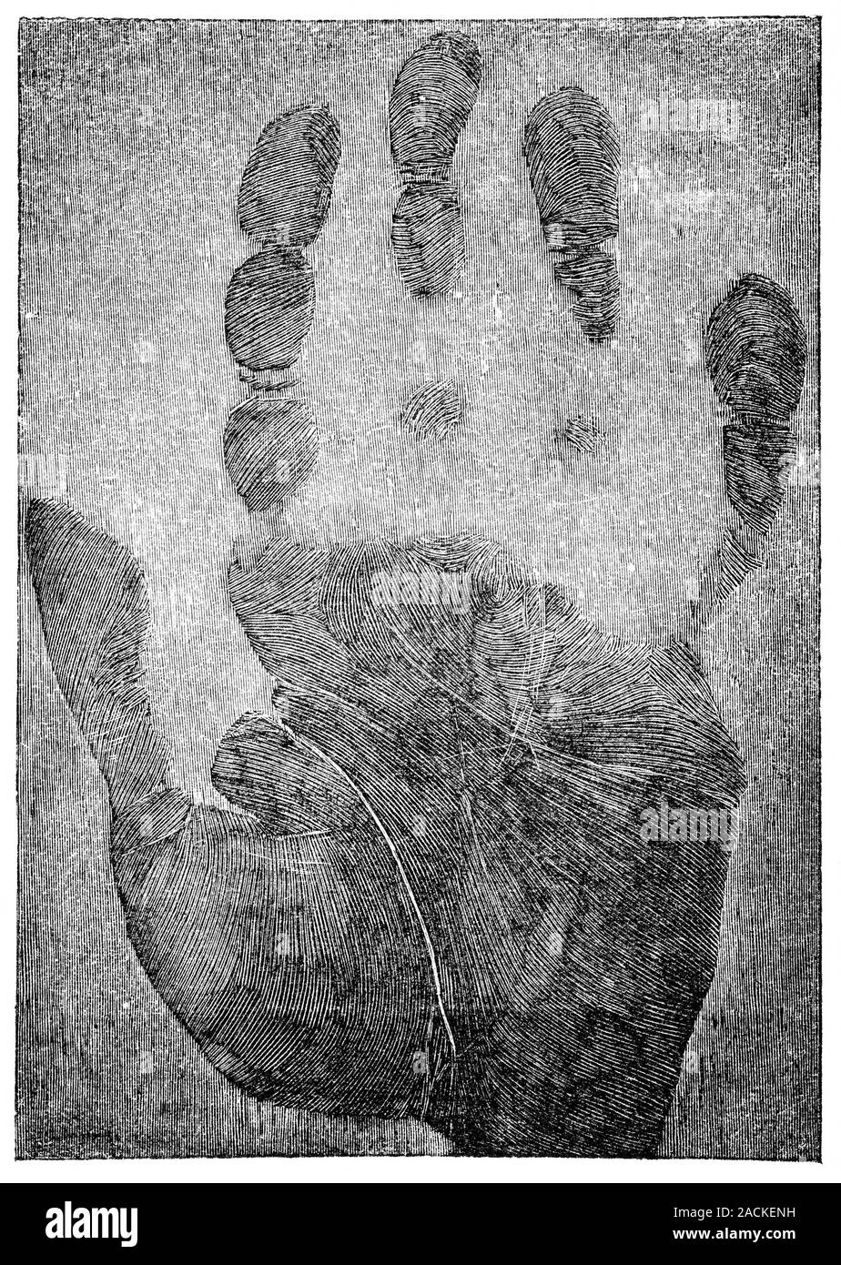 Handprint forensics. Artwork from the tenth volume (second period of ...