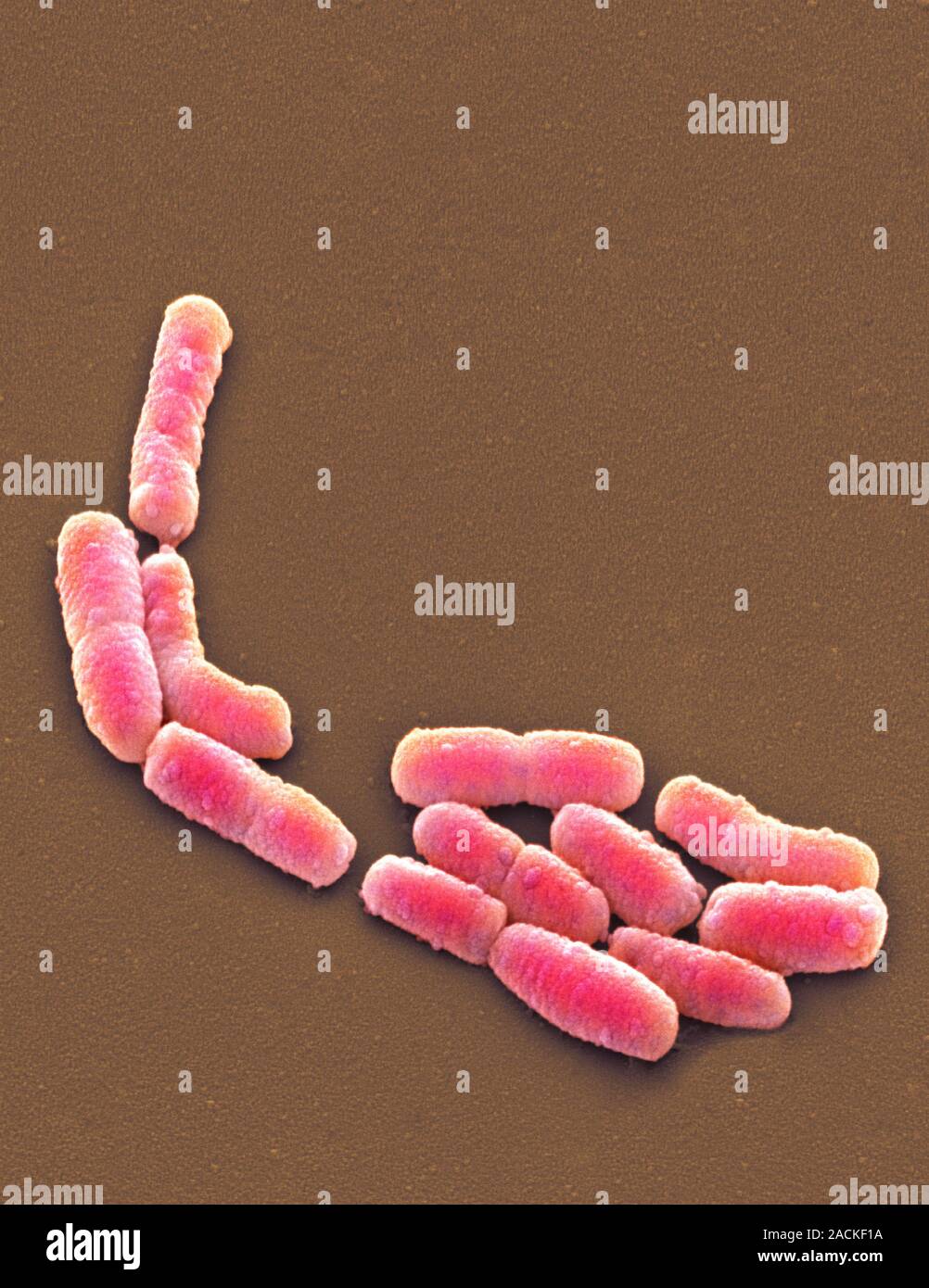 E. coli bacteria. Coloured scanning electron micrograph (SEM) of ...