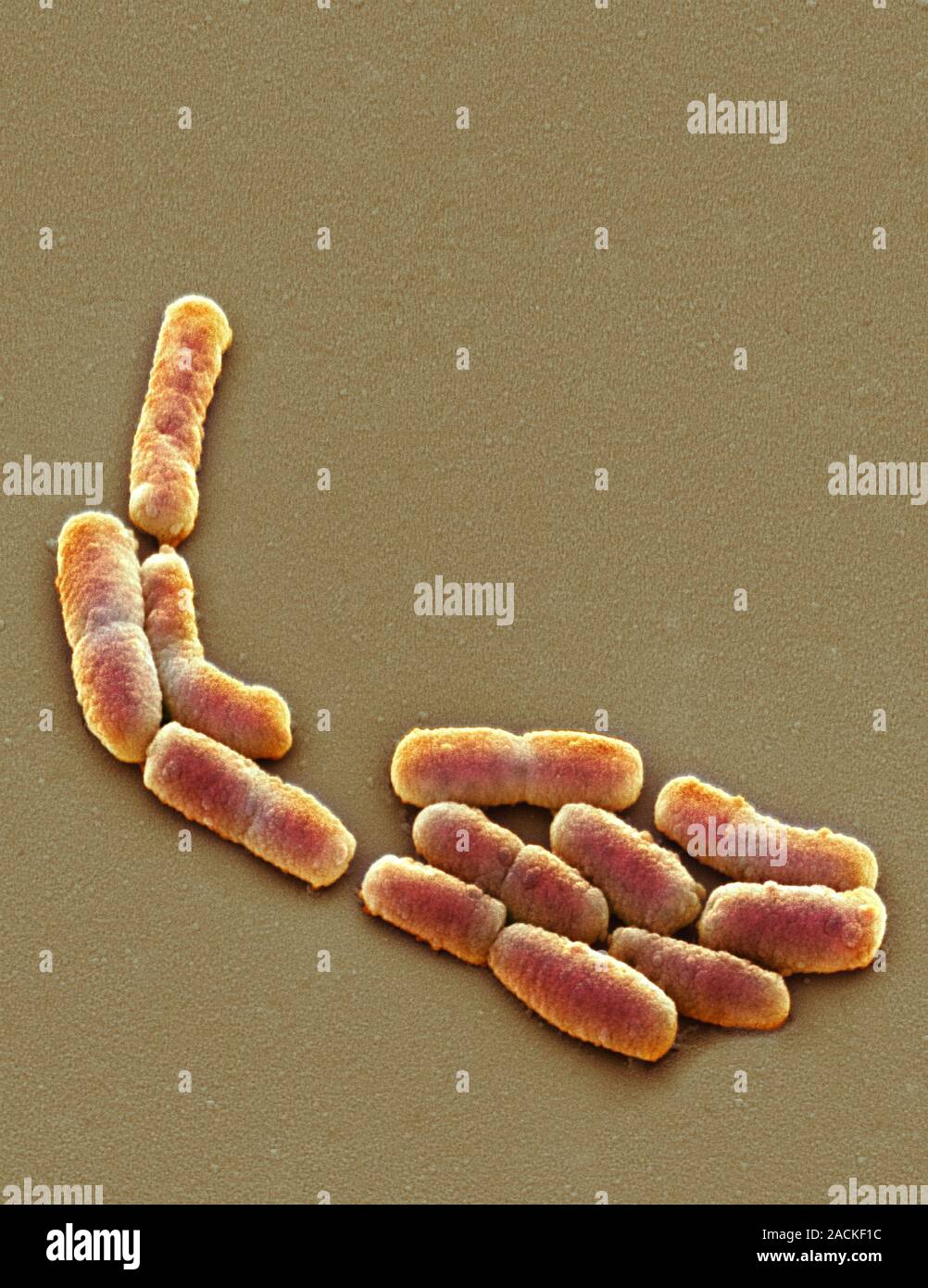 E. coli bacteria. Coloured scanning electron micrograph (SEM) of ...