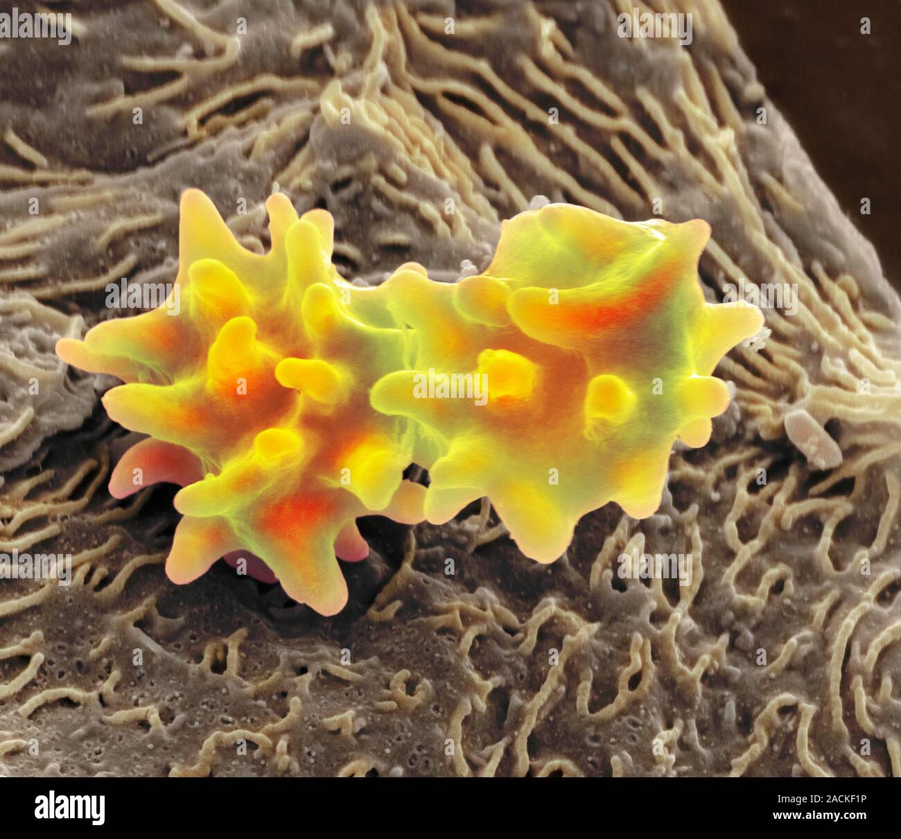 Crenated red blood cells. Coloured scanning electron micrograph (SEM ...