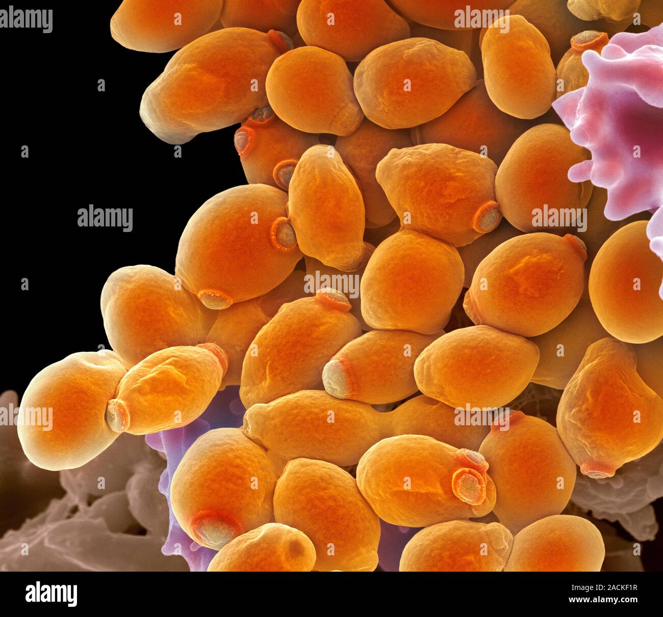 Candida albicans yeast cells. Coloured scanning electron micrograph ...