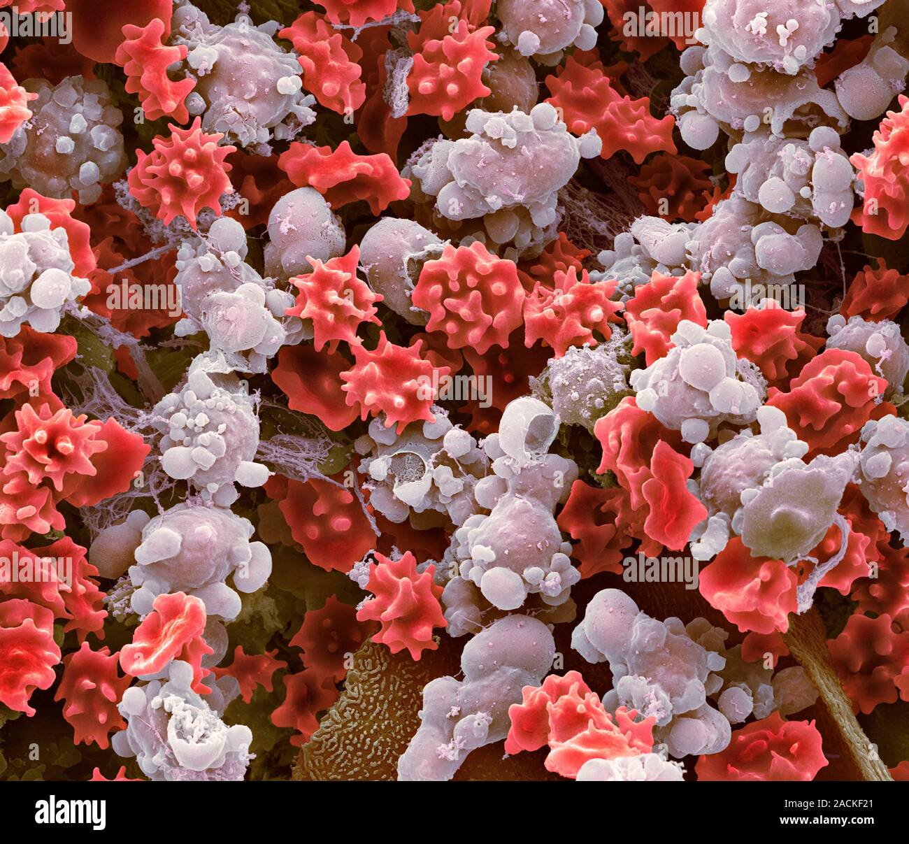 Cells from a urine infection. Coloured scanning electron micrograph ...