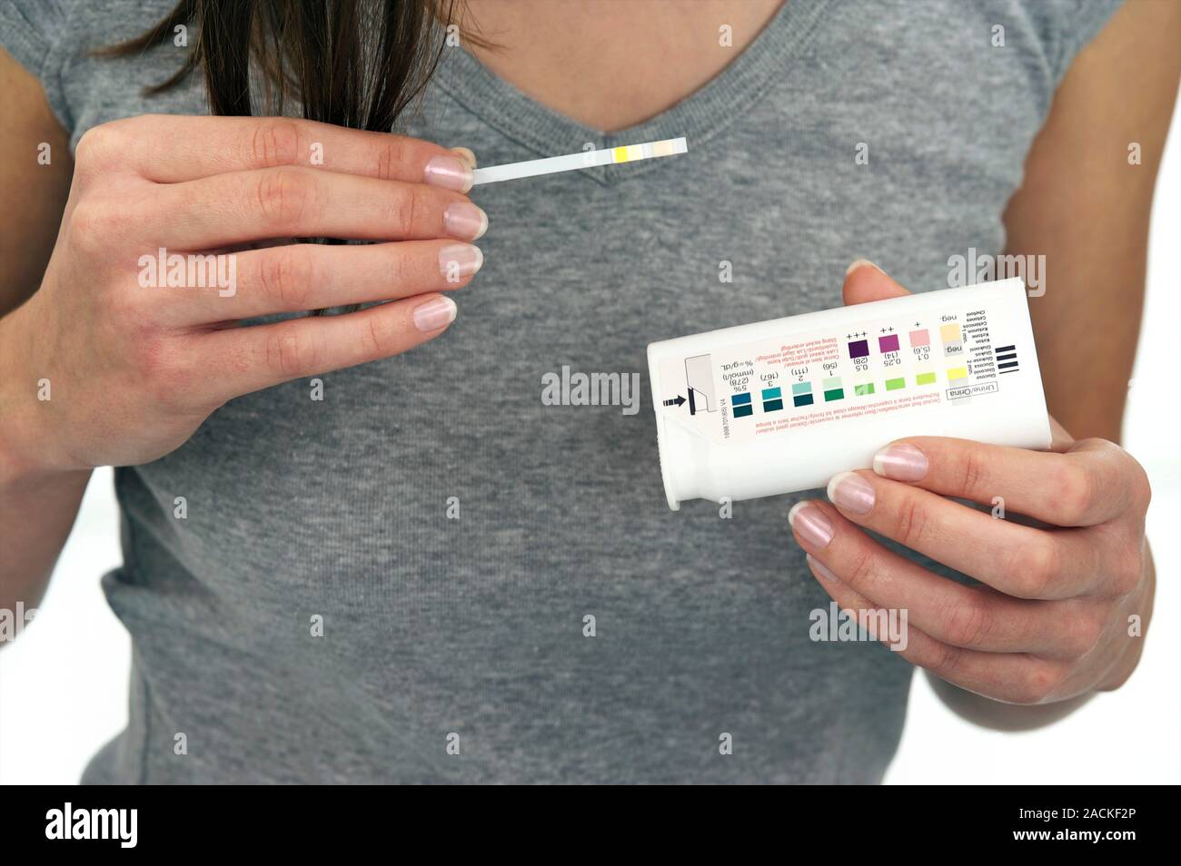 Urine diabetes test. Woman using a urine self-test for diabetes. This ...