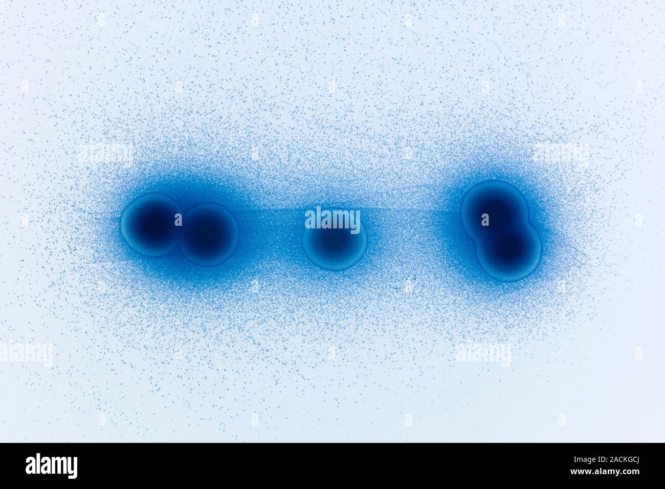 Colonies of the bacterium Escherichia coli, genetically modified to ...