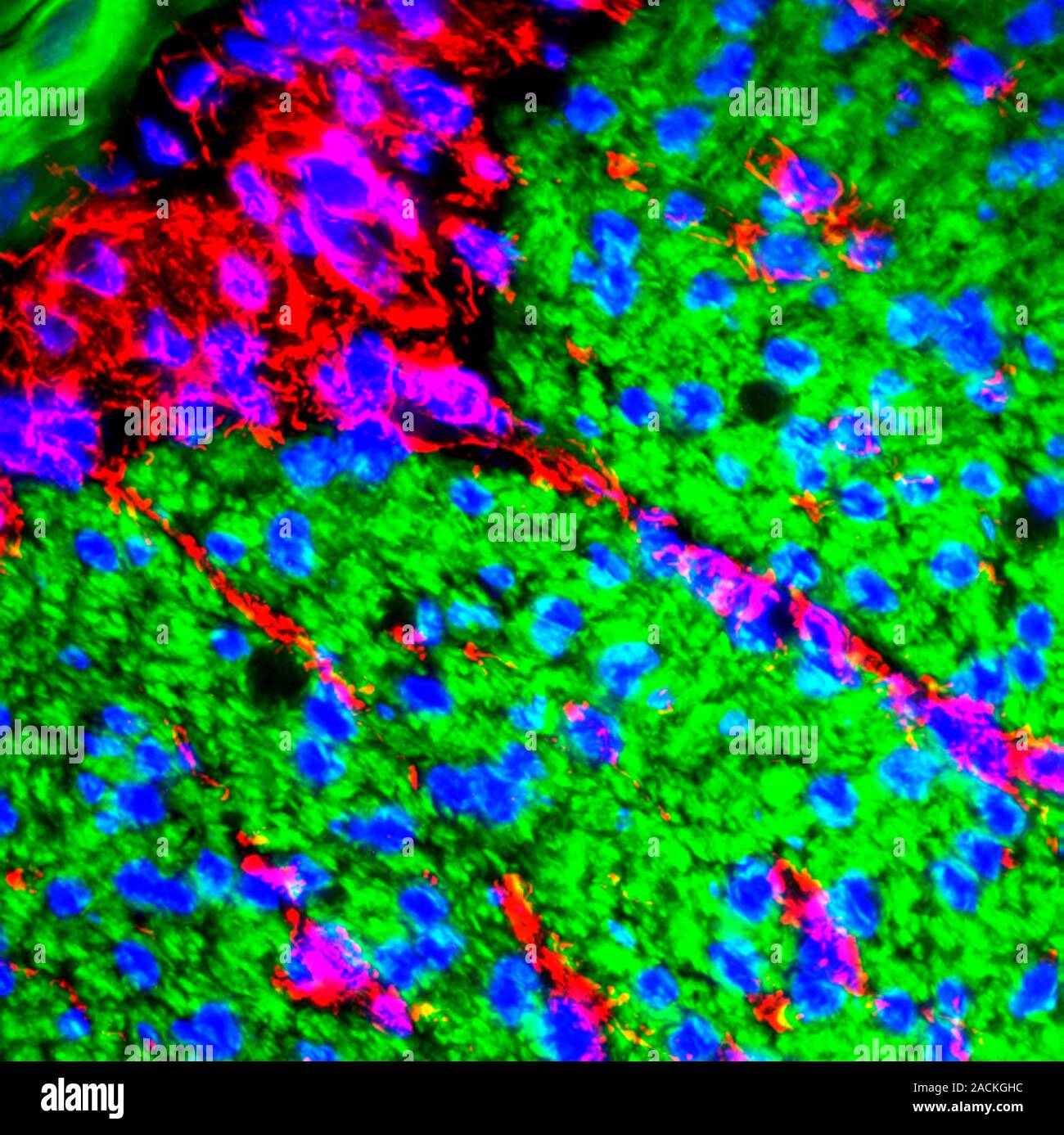 Gut Nerves Fluorescence Deconvolution Micrograph Of A Section Through Abdominal Neural Tissue