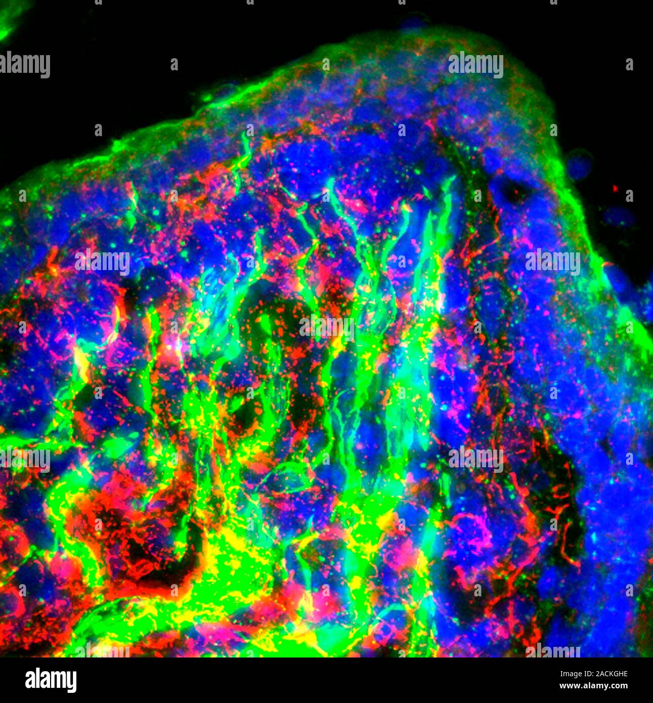 Casr Receptor Fluorescence Deconvolution Micrograph Of A Section Through Tissue Containing A