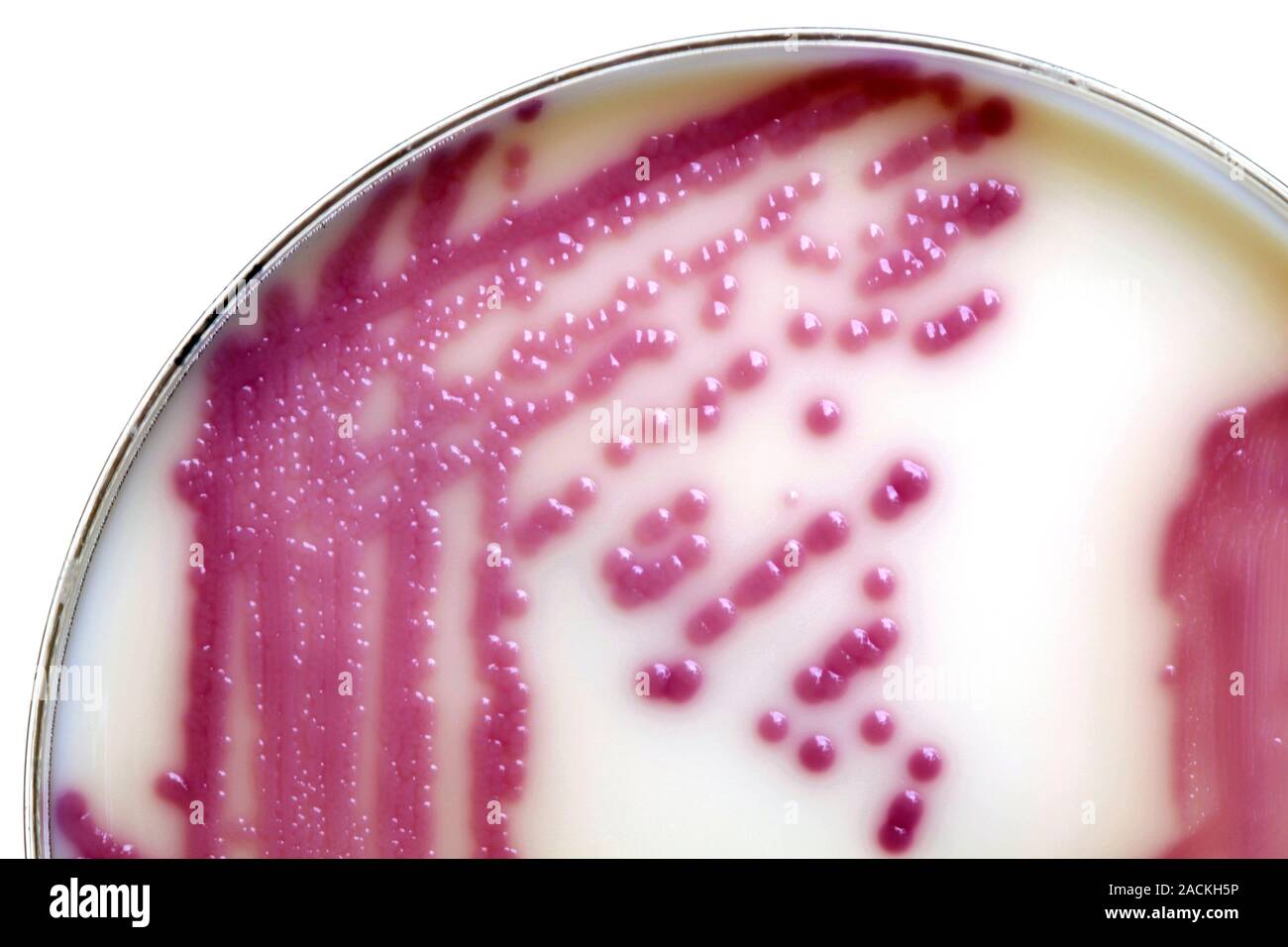 Colonies of Eschericia coli (E. coli) bacteria growing in a petri dish ...