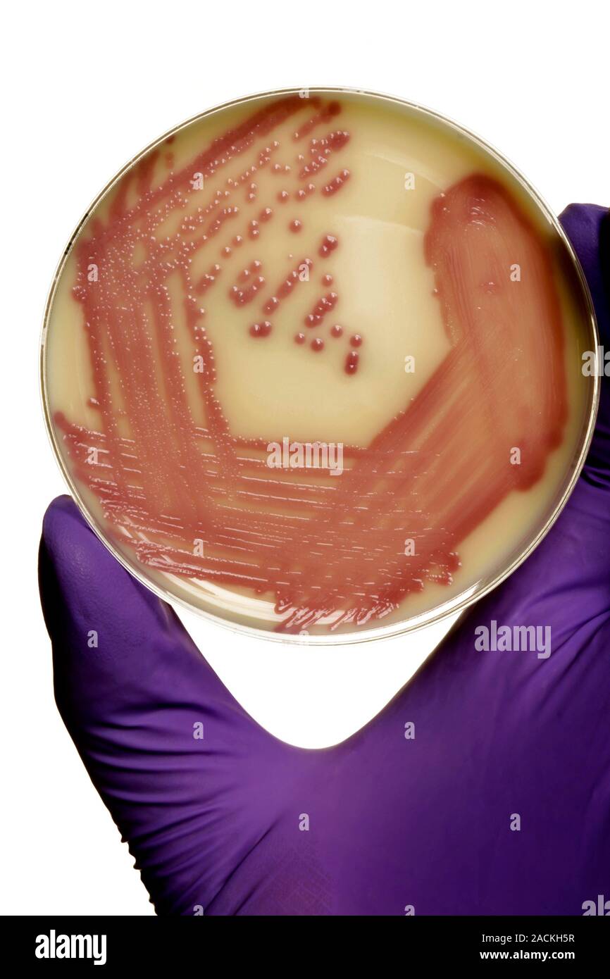 Colonies of Eschericia coli (E. coli) bacteria growing in a petri dish ...