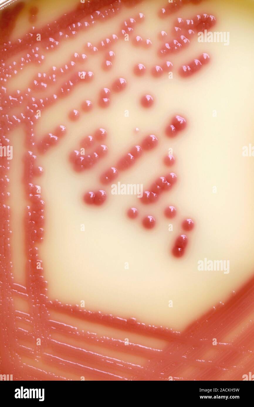 Colonies of Eschericia coli (E. coli) bacteria growing in a petri dish ...