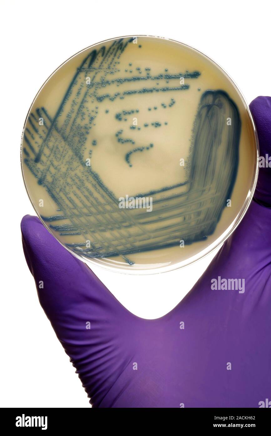Colonies of MRSA (Methicillin-resistant Staphylococcus aureus) bacteria ...